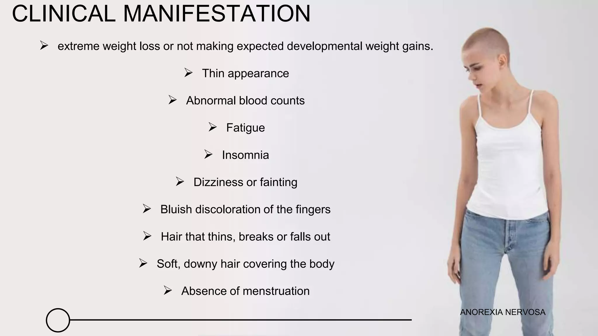 anorexia-NERVOSA.pptx