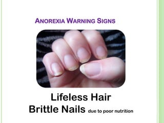 Anorexia Warning Signs Guide | PDF | Digestive Disorders | Diseases and ...