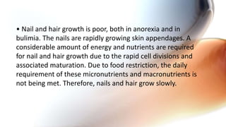 Anorexia and bulimia - medical information , differences, symptoms ...