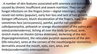 Anorexia and bulimia - medical information , differences, symptoms ...