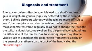 Anorexia and bulimia - medical information , differences, symptoms ...