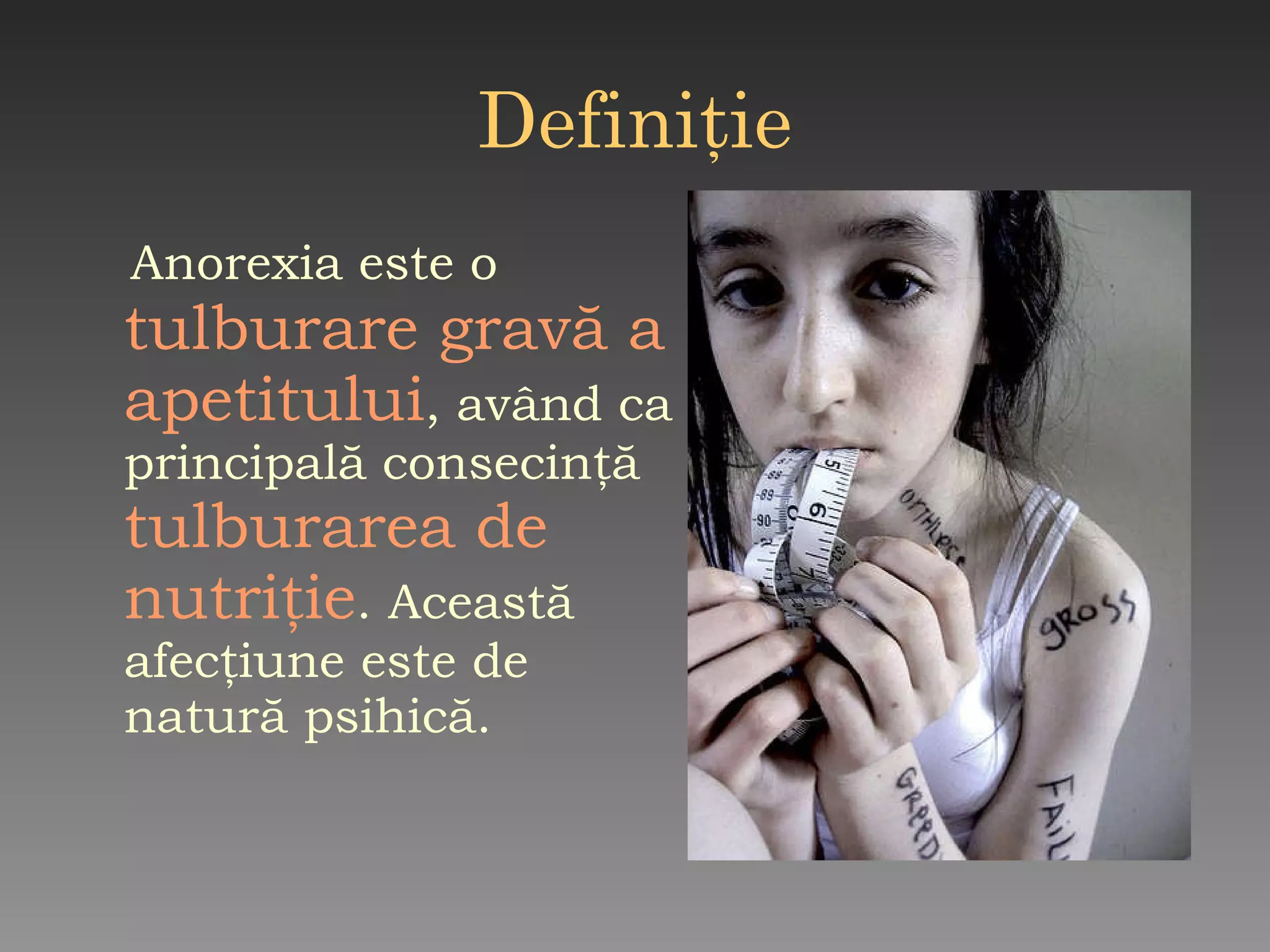 Anorexia nervoasa | PPT