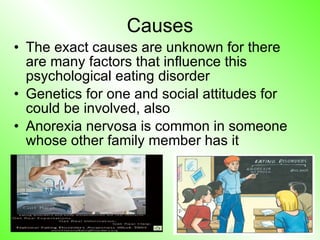 Anorexia Nervosa By Kevin Feng | PPT