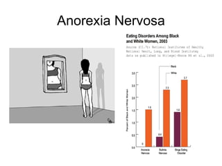 Anorexia Nervosa By Kevin Feng | PPT