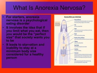 Anorexia Nervosa By Kevin Feng | PPT