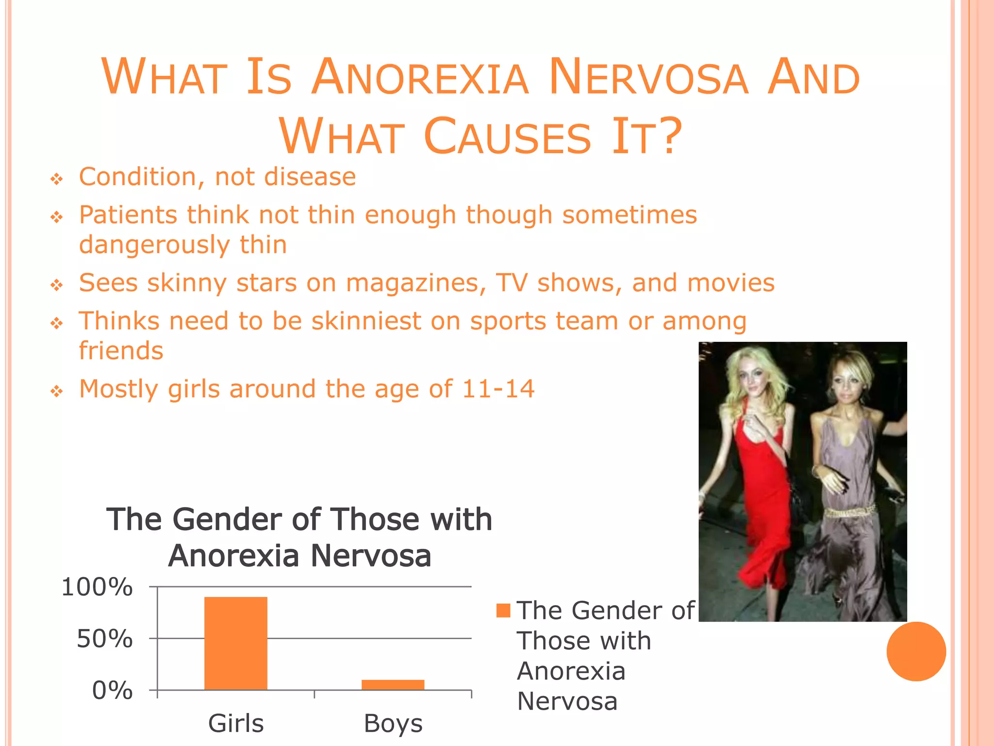 Anorexia nervosa | PPTX | Digestive Disorders | Diseases and Conditions