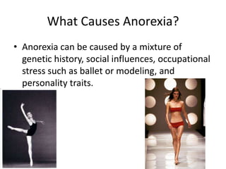 Anorexia nervosa | PPT