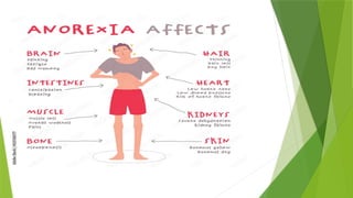 Anorexia Nervosa.pptx Eating disorder, loss of appetite | PPTX