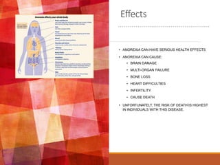 Anorexia nervosa ppt | PPTX