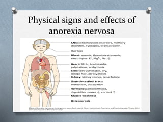 Anorexia nervosa | PPTX