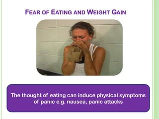 Anorexia Nervosa Symptoms Guide | PDF