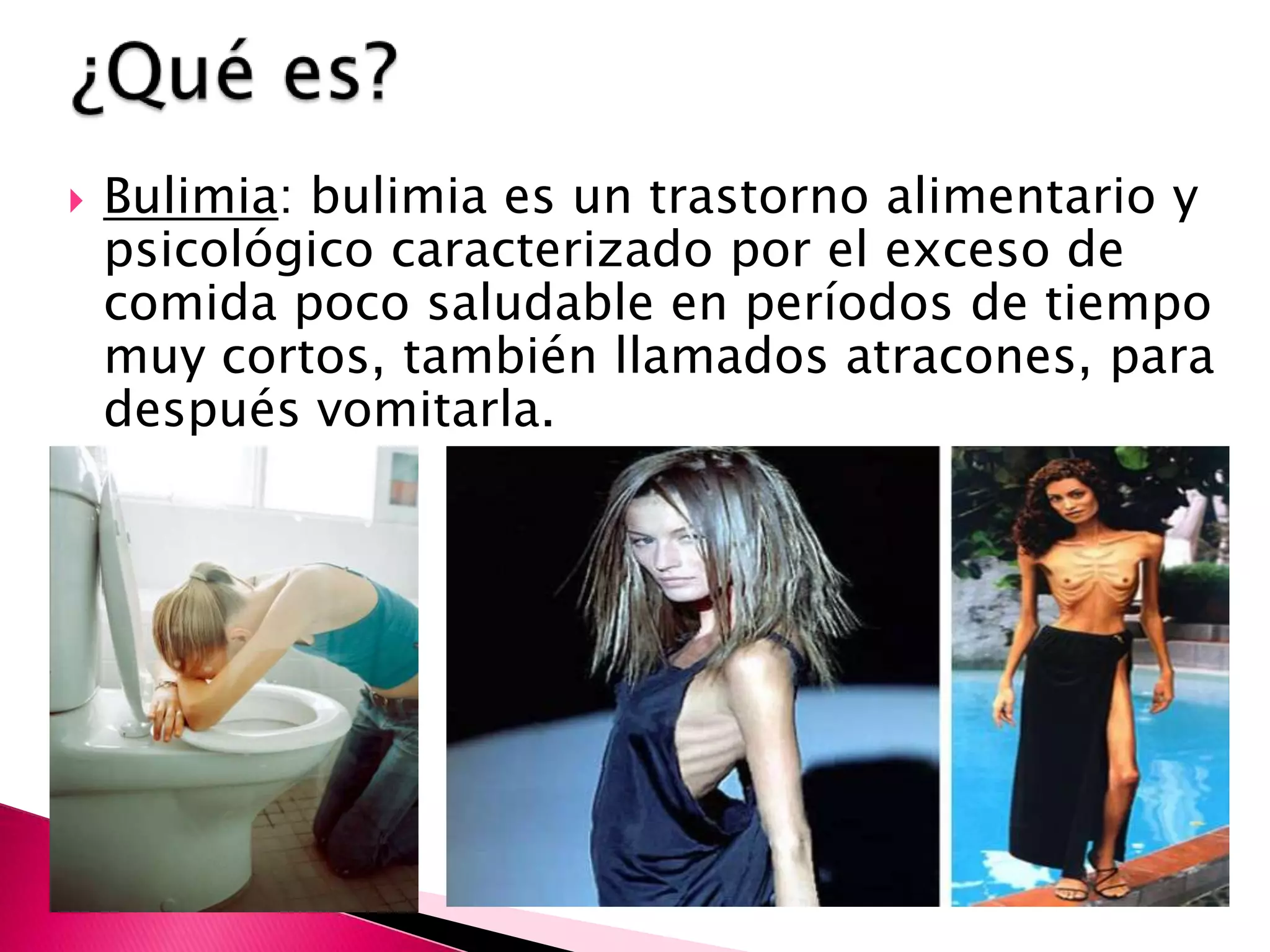 Anorexia y bulimia | PPTX | Digestive Disorders | Diseases and Conditions