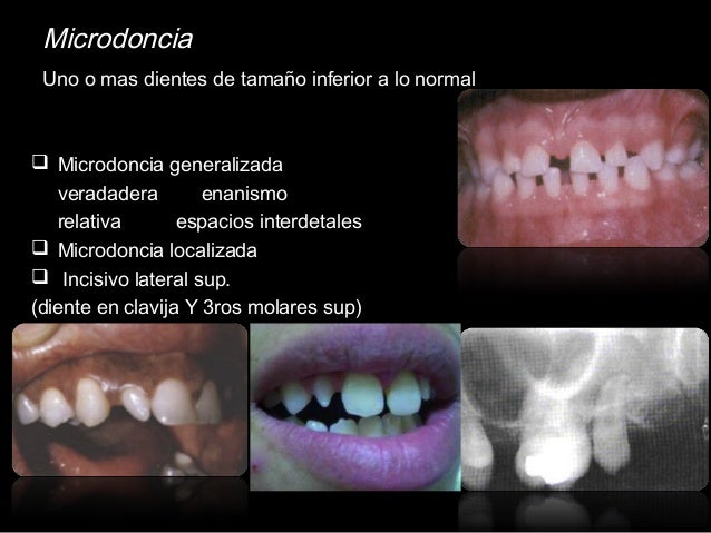 Anomalías Dentarias