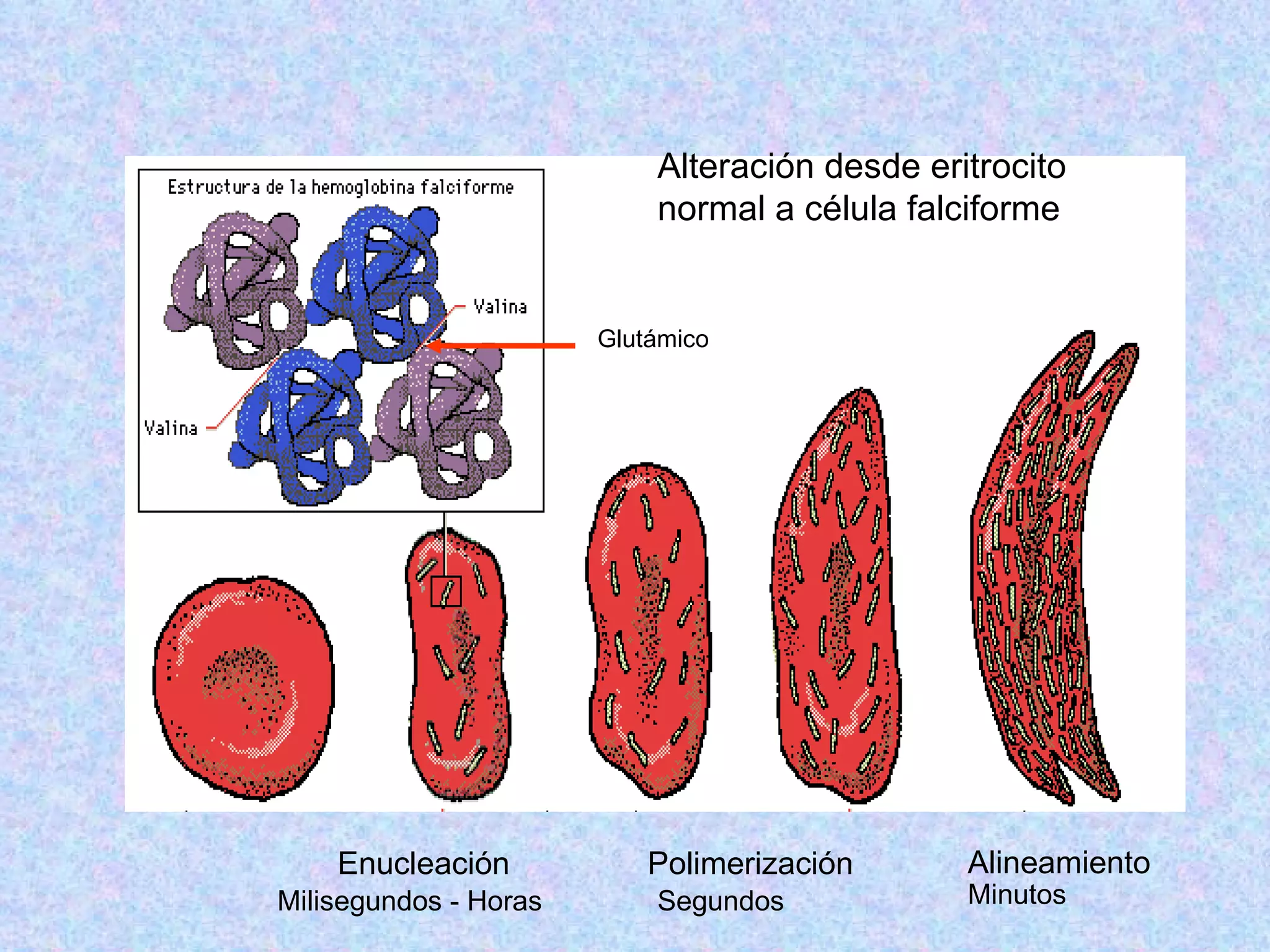Anormalidades biosintesis de la globina | PPT