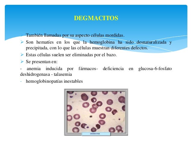 Anormalidades del tejido sanguíneo - Alejandra Torres