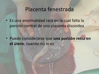 Anormalidades de placenta | PPTX