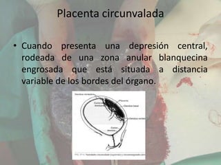 Anormalidades de placenta | PPTX