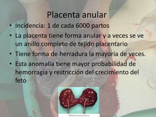 Anormalidades de placenta | PPTX