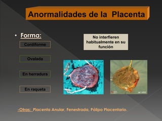Anormalidades de placenta cordon y liquido | PPTX