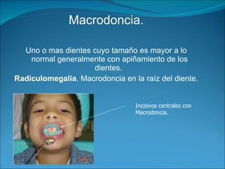 Anormalidades Embriologicas | PPT