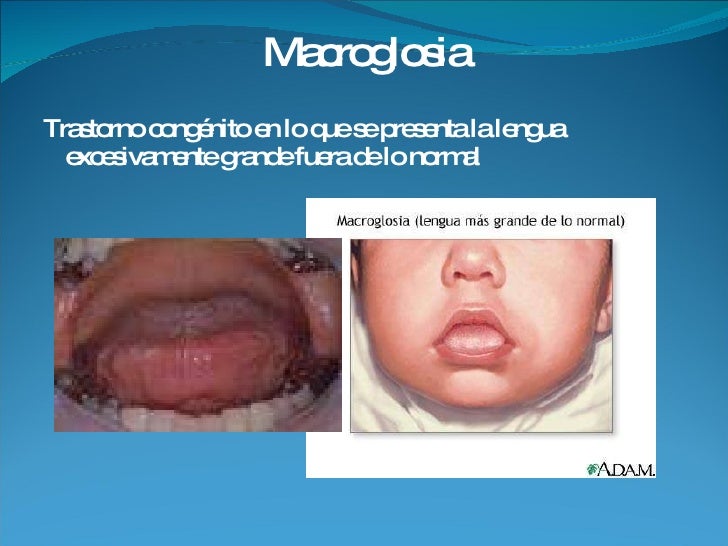 Anormalidades Embriologicas