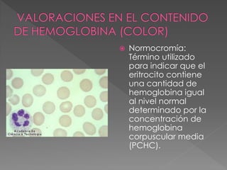 Anormalidades+morfológicas+de+los+eritrocitos | PDF