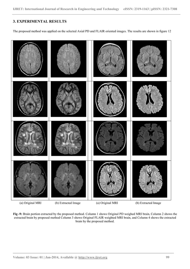 A novel approach for efficient skull stripping using | PDF