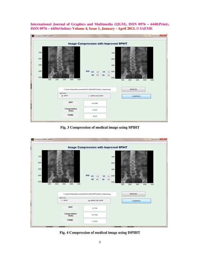 A Novel Technique In Spiht For Medical Image Compression Pdf