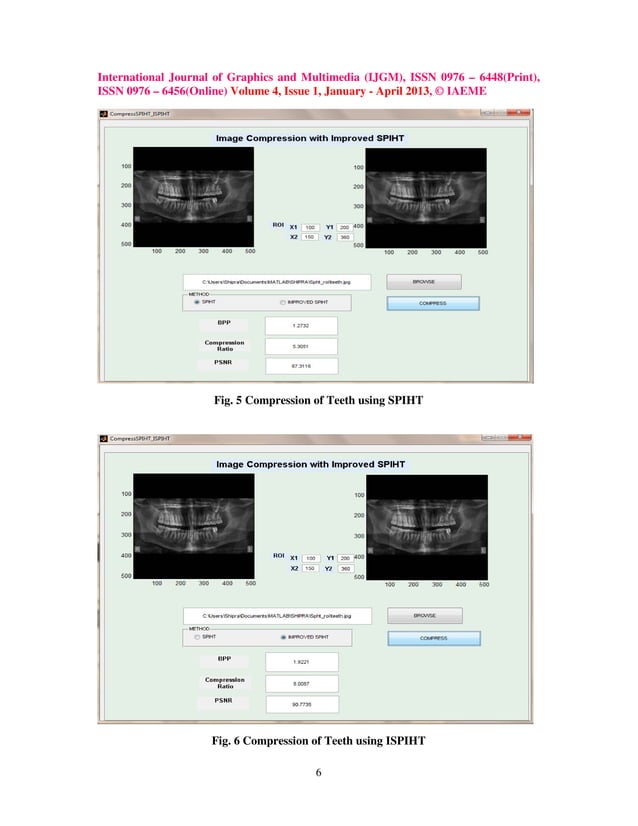 A Novel Technique In Spiht For Medical Image Compression Pdf 