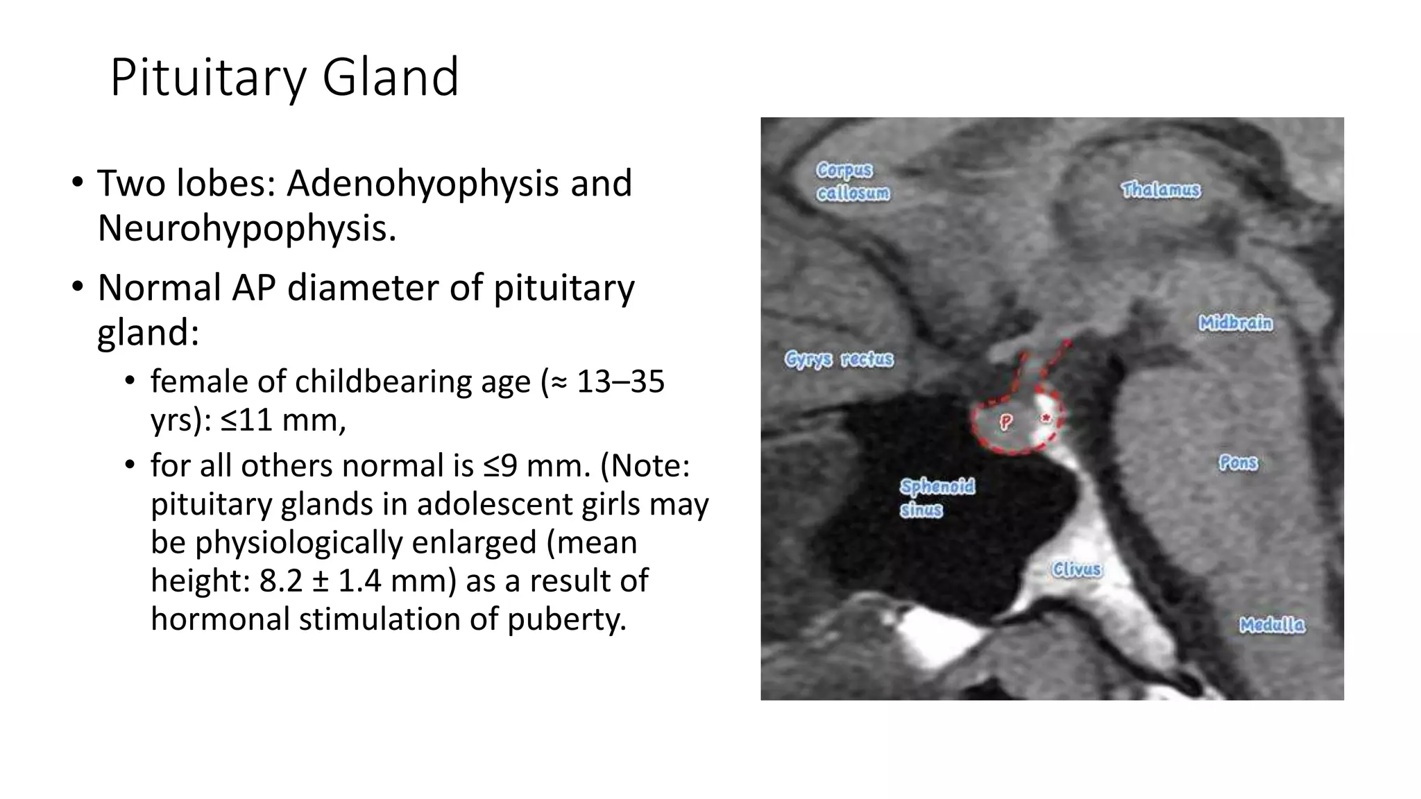 An Overview Of Endoscopic Endonasal Trans Sphenoidal Approach Pptx