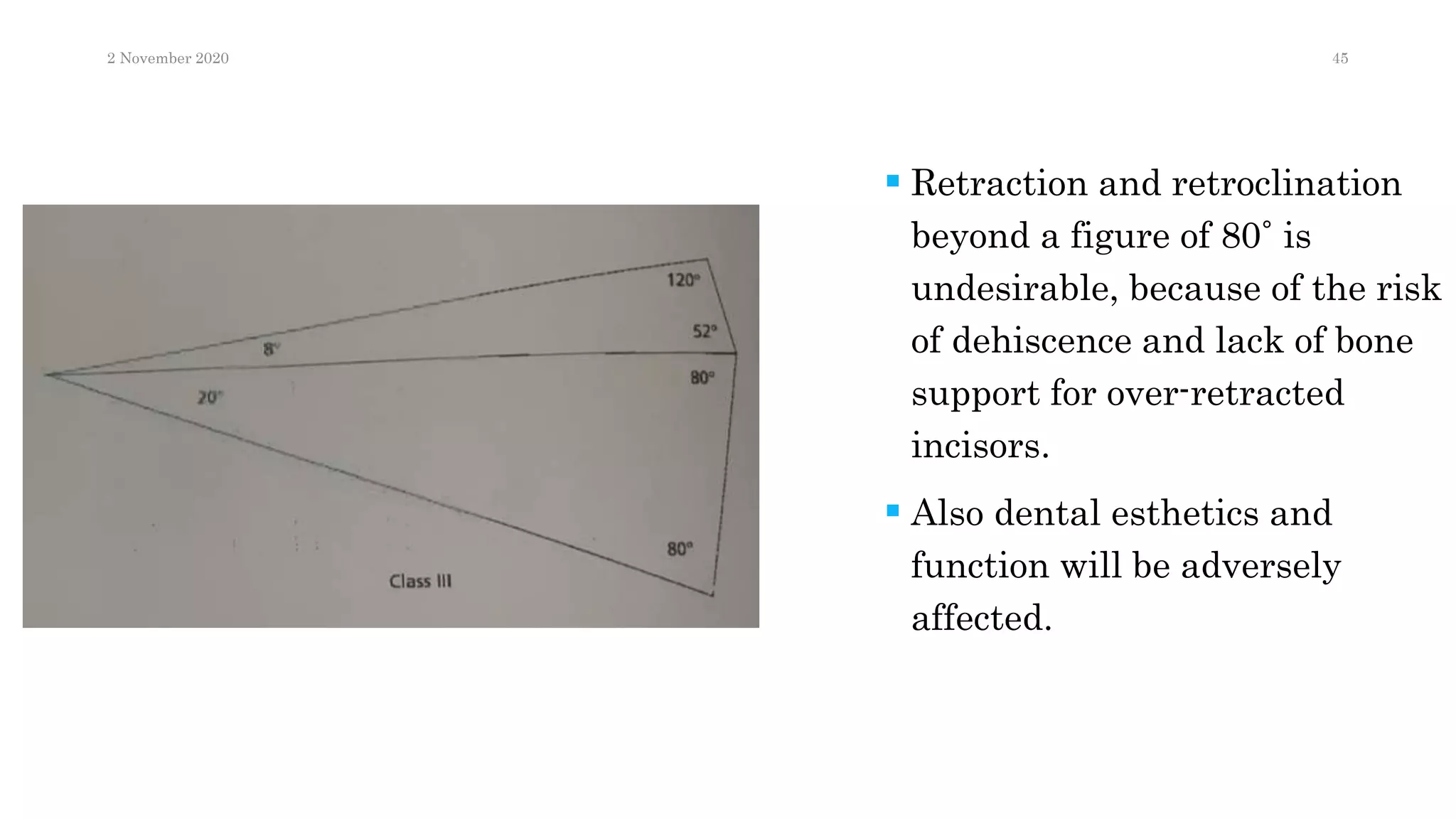 An overview of class III treatment in fixed Orthodontics by MBT system ...