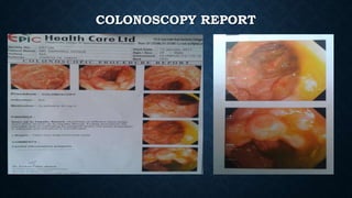 An overview of colorectal carcinoma at oncology department new | PPTX