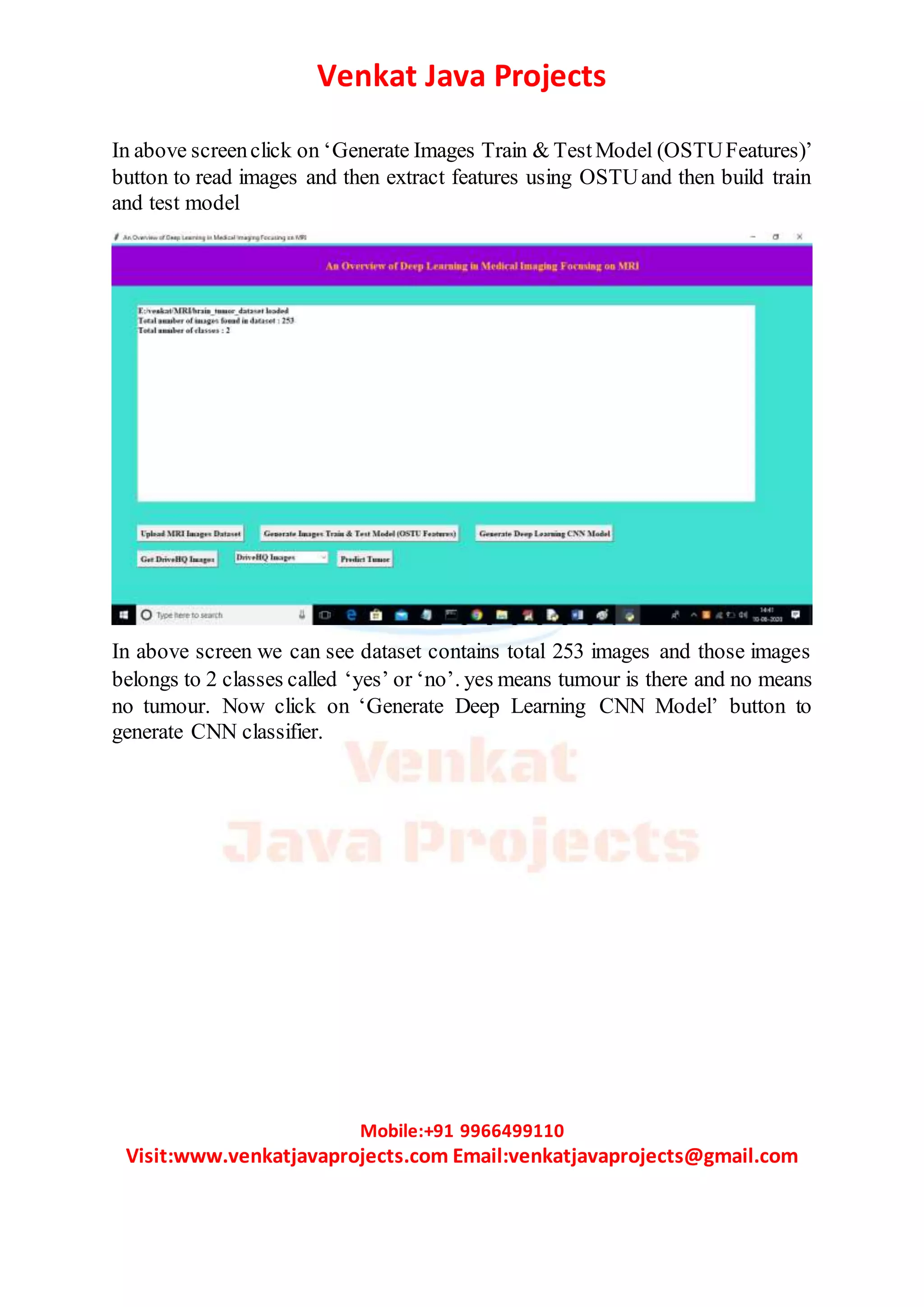 An overview of deep learning in medical imaging focusing on mri ...