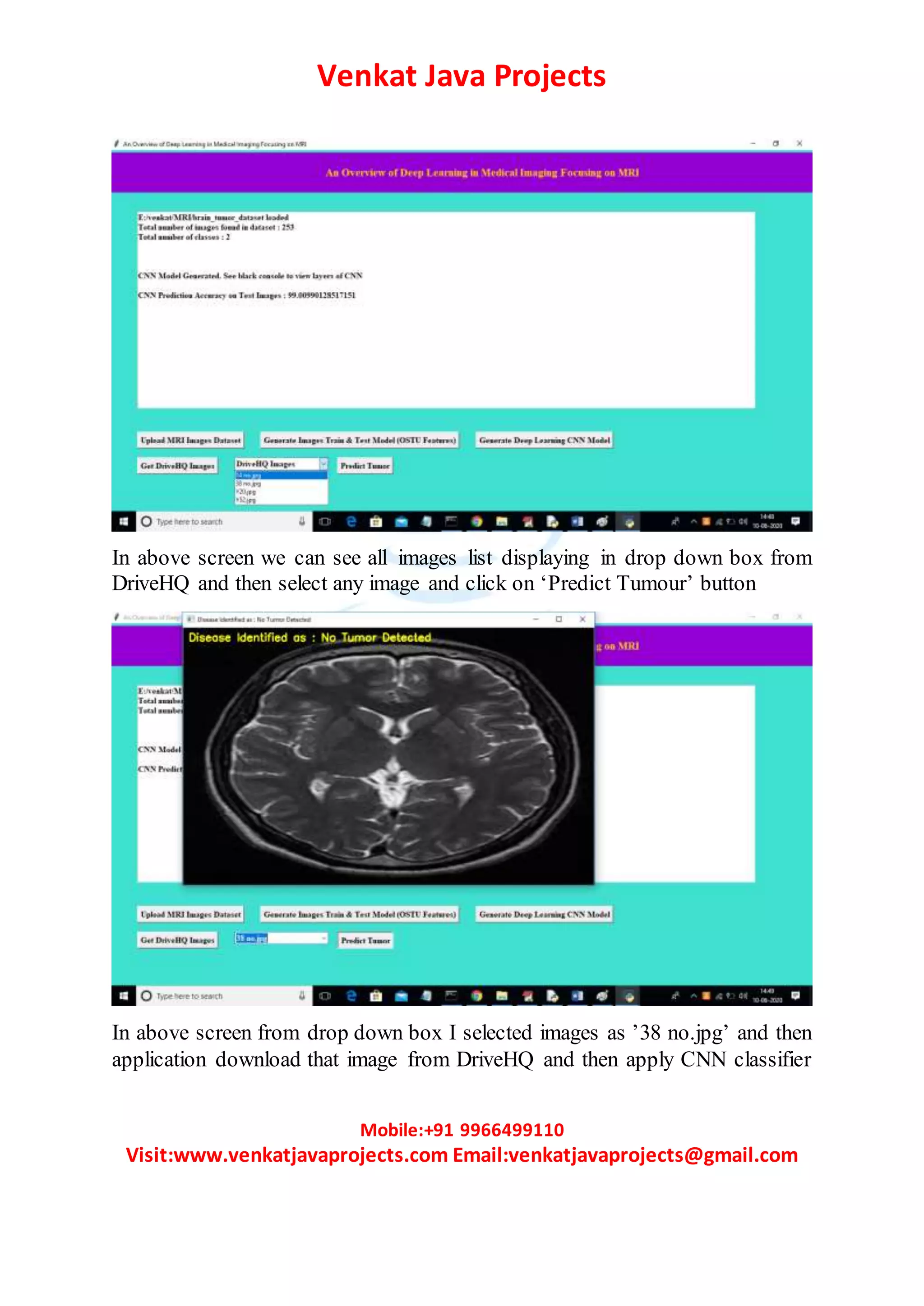 An overview of deep learning in medical imaging focusing on mri ...
