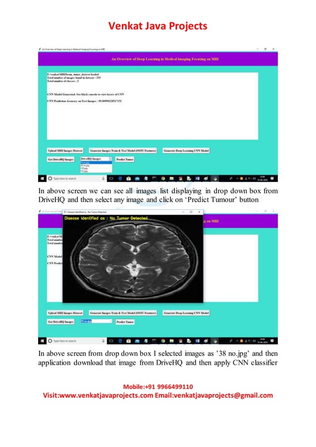 An overview of deep learning in medical imaging focusing on mri ...