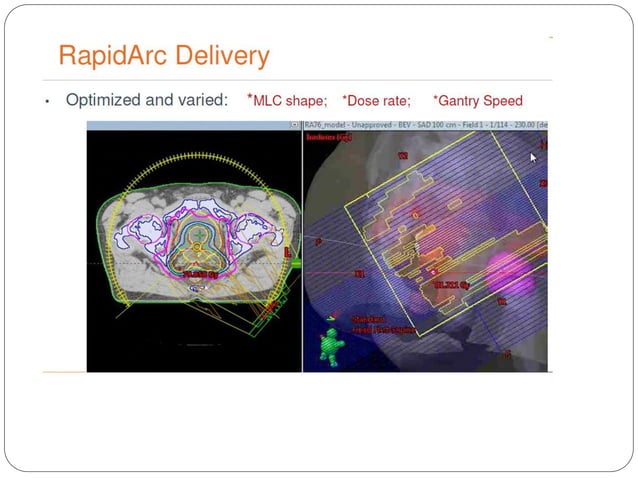 An overview of imrt, vmat optimization algorithms | PDF | Medical Health