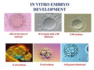 An overview of IVF/ICSI | PPTX