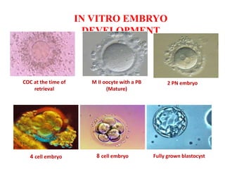 An overview of IVF/ICSI | PPTX