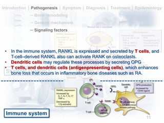 An overview of osteoporosis | PDF