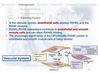 An overview of osteoporosis | PDF