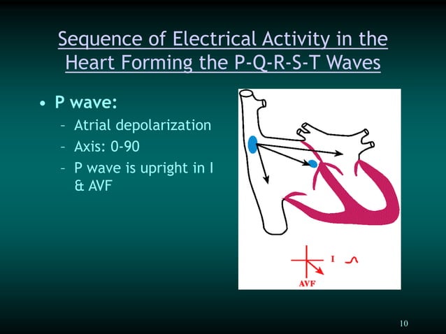 An overview of paediatric ECG | PDF