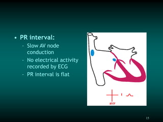 An overview of paediatric ECG | PDF