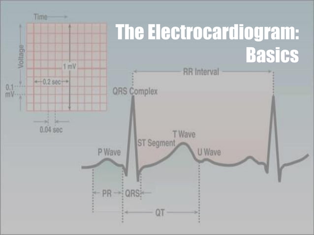 An overview of paediatric ECG | PDF