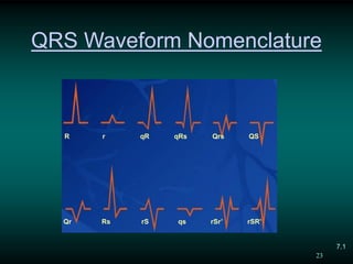 An overview of paediatric ECG | PDF