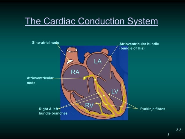 An overview of paediatric ECG | PDF