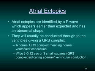An overview of paediatric ECG | PDF