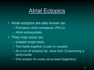 An overview of paediatric ECG | PDF