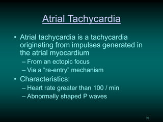 An overview of paediatric ECG | PDF