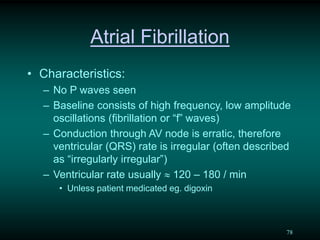 An overview of paediatric ECG | PDF