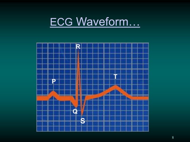 An overview of paediatric ECG | PDF